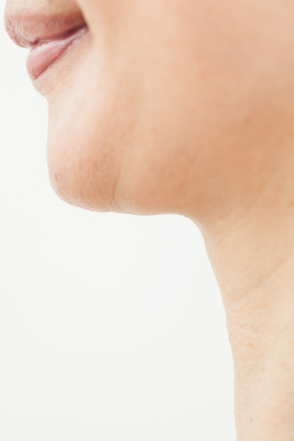 Elucidation of the cause of "sagging of the face" -St. Marianna ...