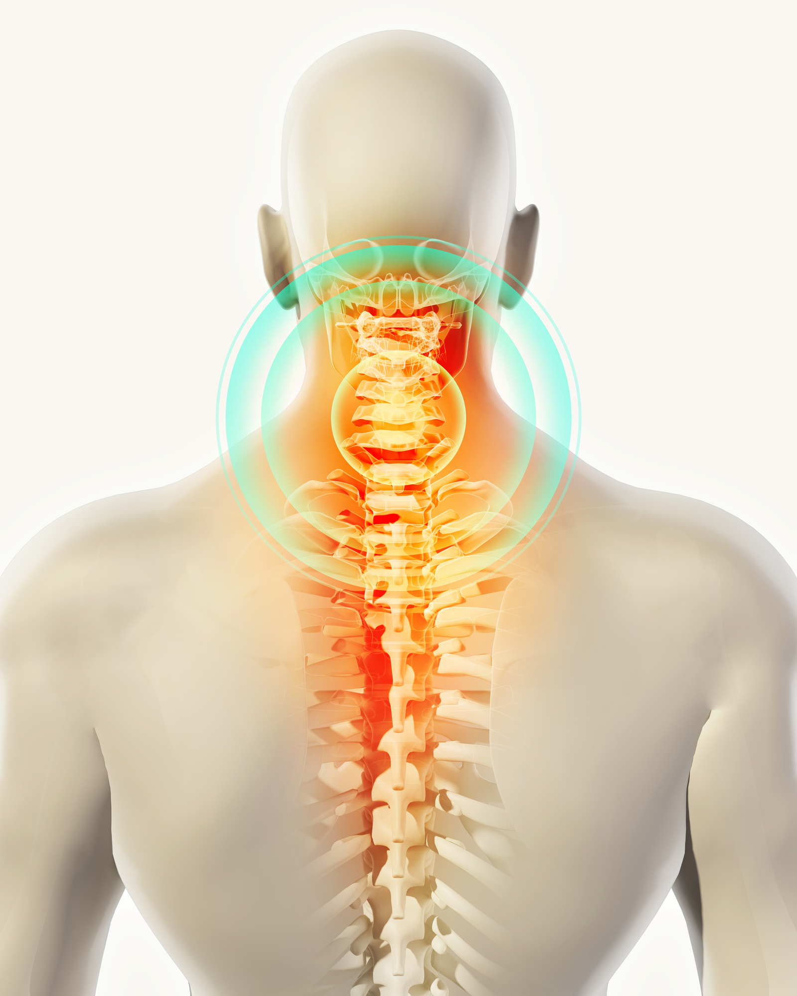 Surgery within 24 hours accelerates recovery of paralysis in patients ...