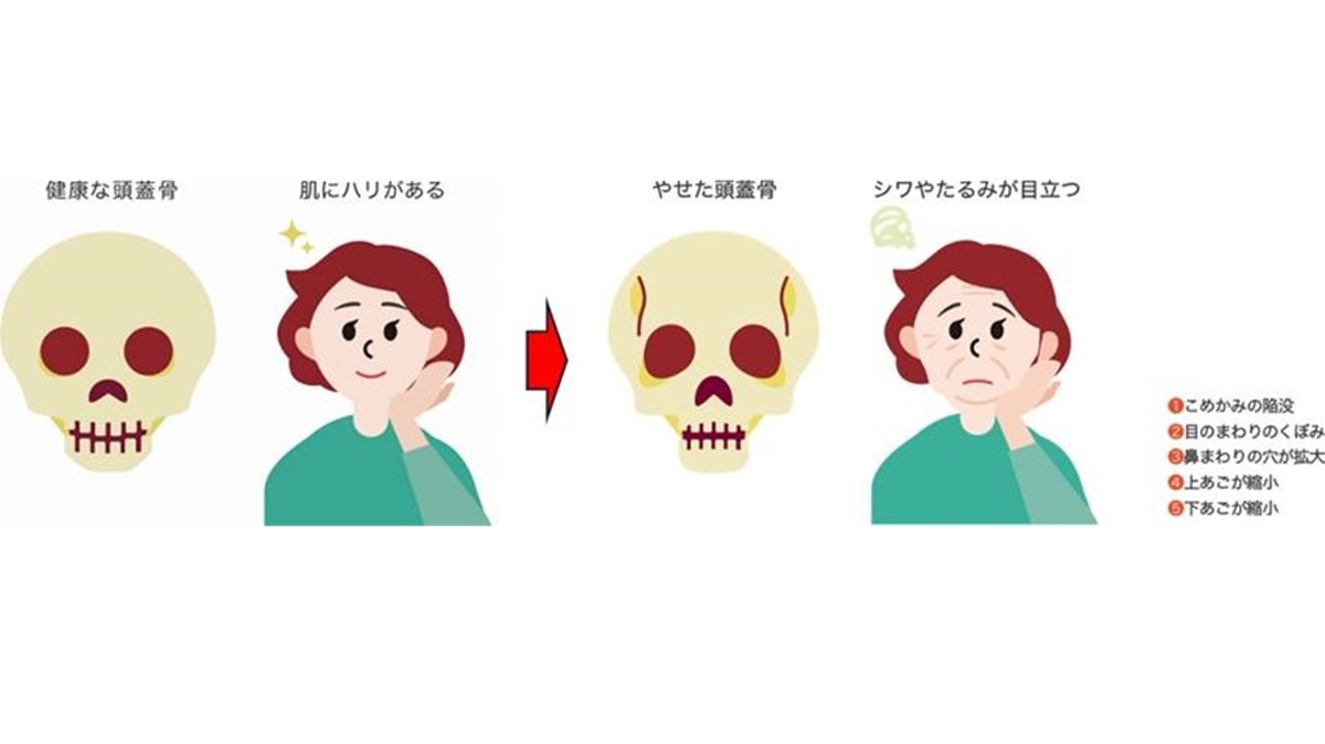 Facial bone density decreases before menopause: Chubu University ...
